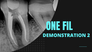 One-Fil Bioceramic Root Canal Sealer